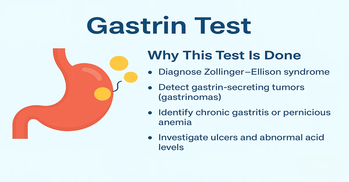 Gastrin Test: Meaning, High Levels, Functions & Normal Ranges